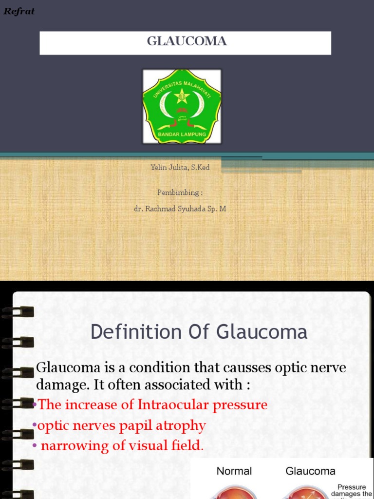 Glaucoma: Yelin Julita, S.Ked | PDF | Glaucoma | Diseases Of The Eye And Adnexa