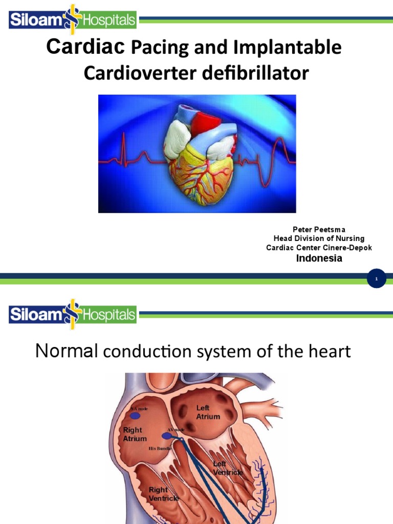 Cardiac Pacing and ICD | Download Free PDF | Artificial Cardiac ...