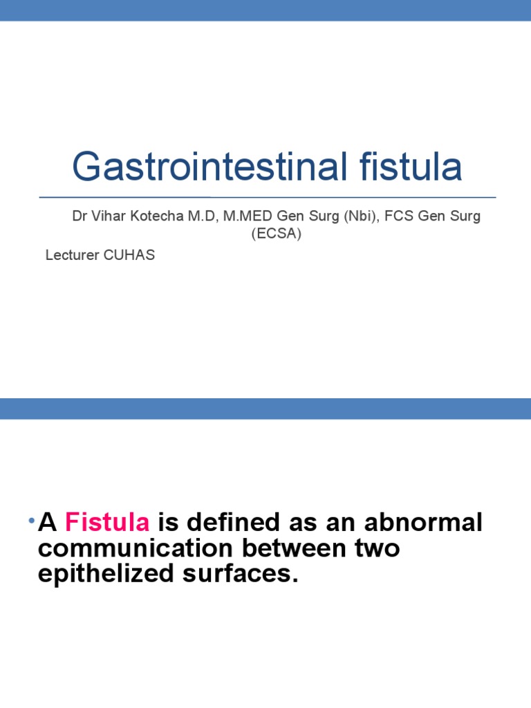 Gastrointestinal Fistula: DR Vihar Kotecha M.D, M.MED Gen Surg (Nbi ...