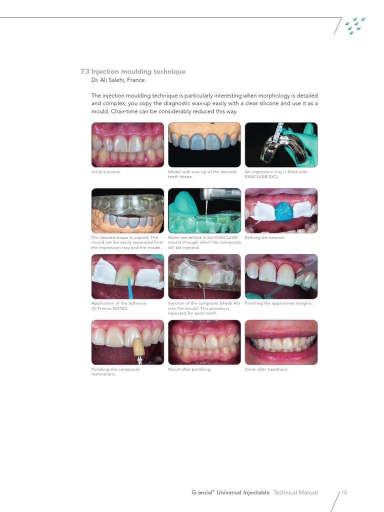 Injection Moulding Technique Pdf Pdf