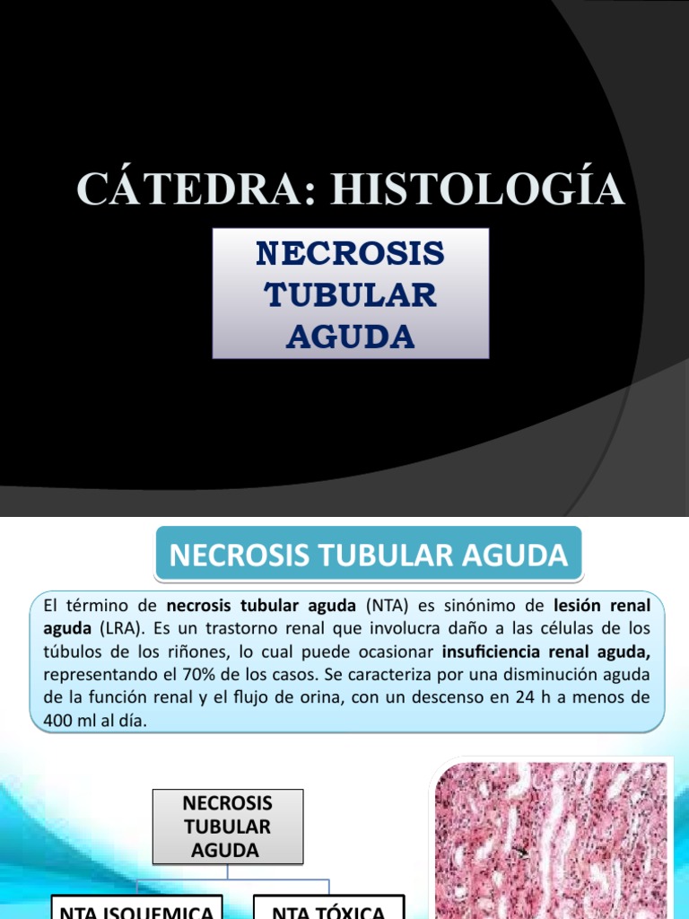 NECROSIS TUBULAR AGUDAa | PDF