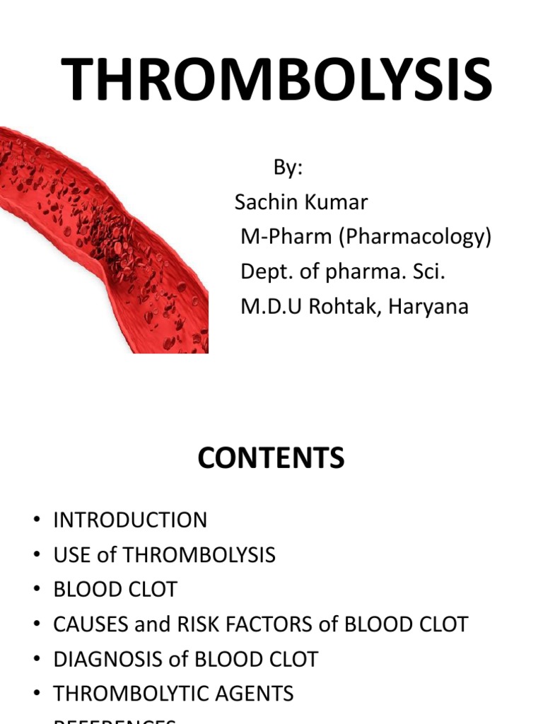 Thrombolysis for Medical Professionals | PDF
