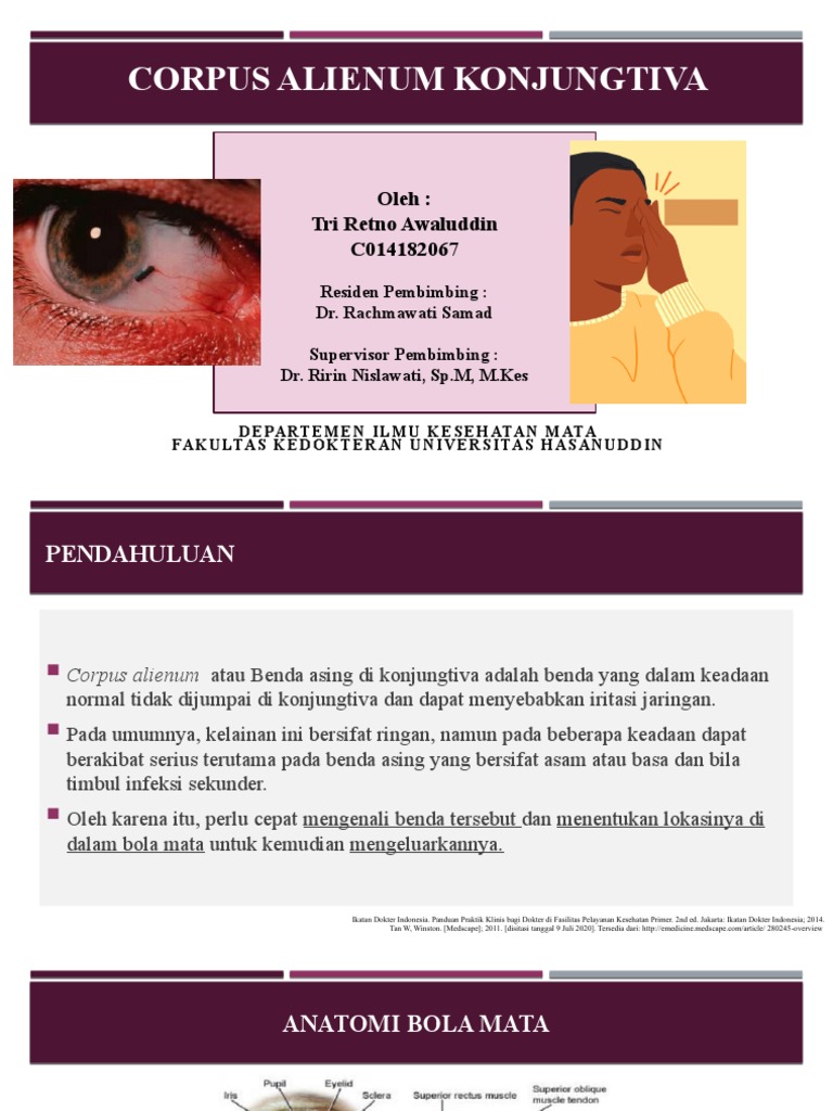 Corpus Alienum Konjungtiva | PDF