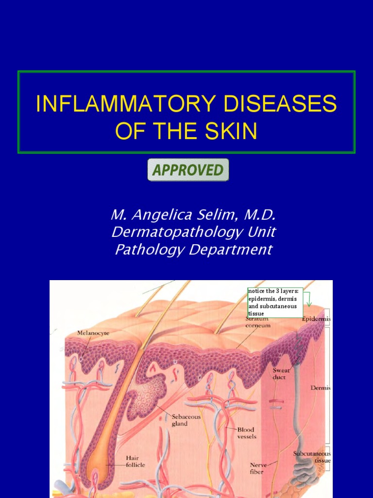 Inflammatory Diseases Of The Skin M Angelica Selim M D