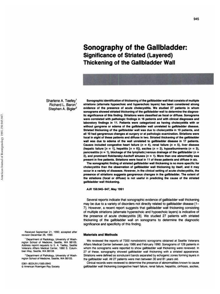 Significance of Striated (Layered) Thickening of The Gallbladder Wall ...