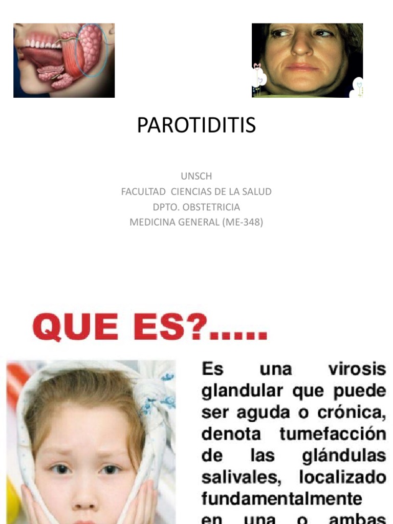 PAROTIDITIS | PDF