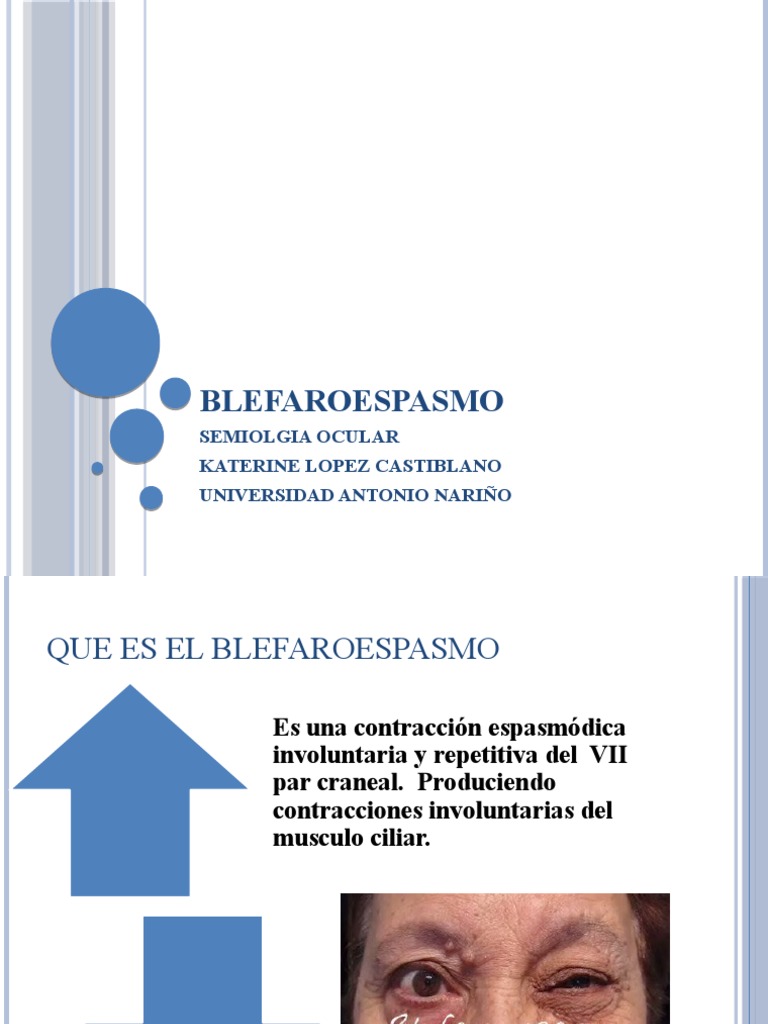 Blefaroespasmo | PDF