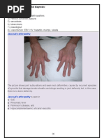 Systemic Lupus Erythematosus Assignment | PDF | Systemic Lupus ...