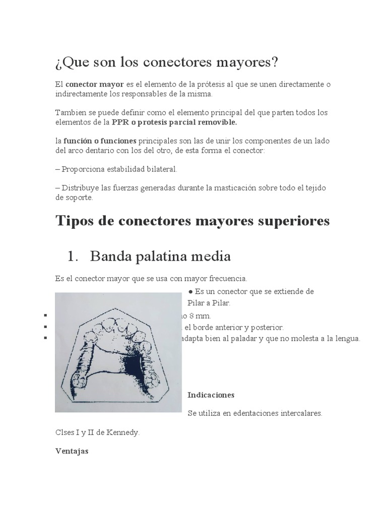 Conectores Mayores PPR | Descargar gratis PDF | Boca | Ramas de Odontología