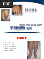 Tipos de Edemas | PDF | Edema | Medicina