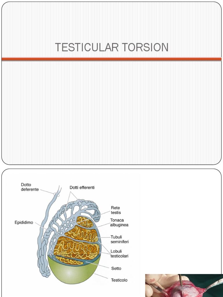 Torsio Testis | PDF