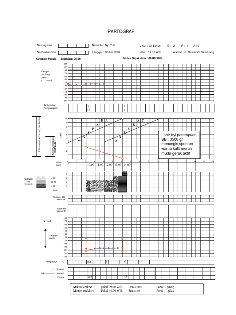 Partograf 1 | PDF