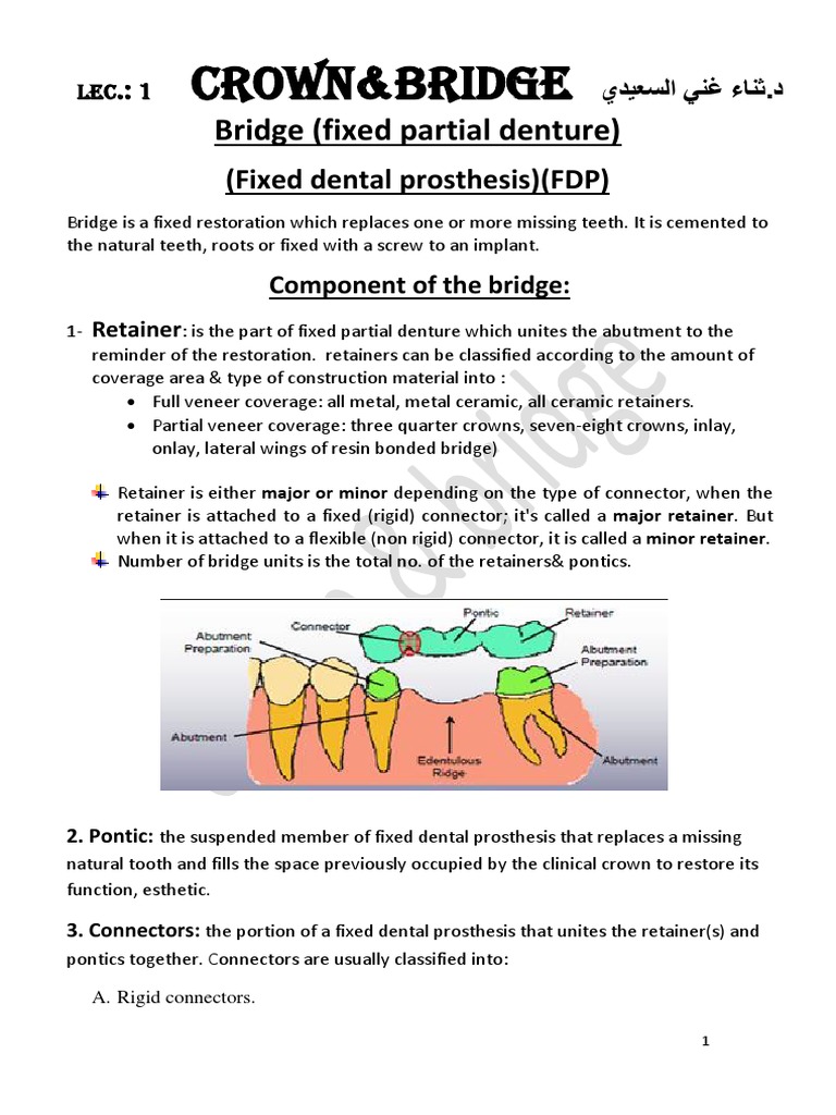 Lec1 - Bridge (Fixed Partial Denture | PDF | Periodontology | Dental ...