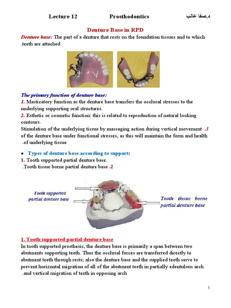 Denture Base in RPD Lec 12 | PDF | Dentures | Dental Implant