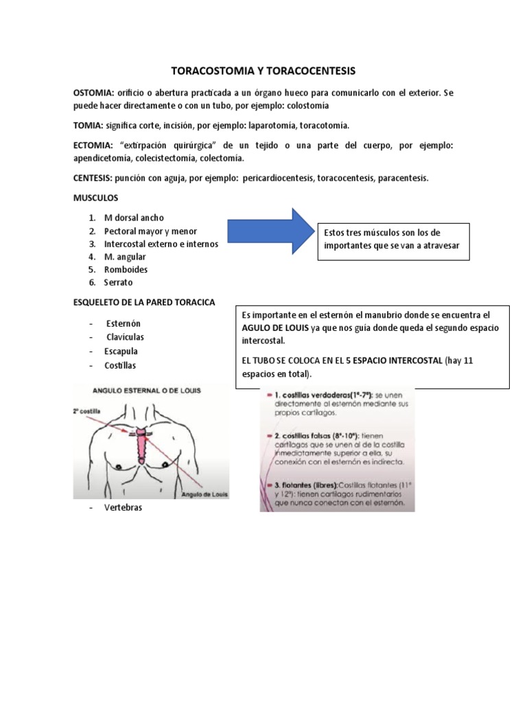 Toracostomía y Toracocentesis: Guía Práctica | PDF | Medicina | Tórax ...