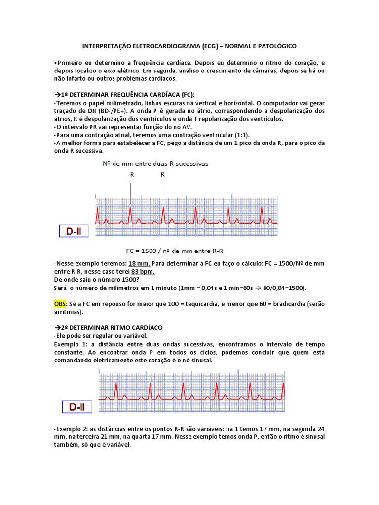 Interpretação de ECG - Resumo | PDF | Eletrocardiografia | Coração