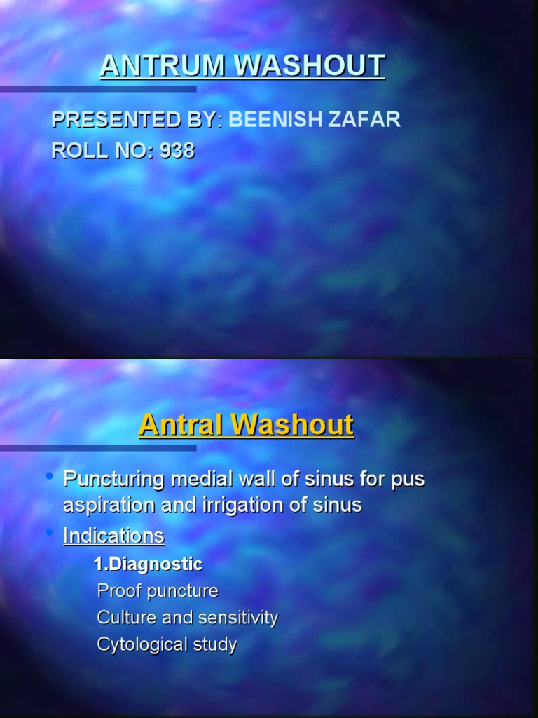 Chronic Sinusitis | PDF | Clinical Medicine | Human Head And Neck