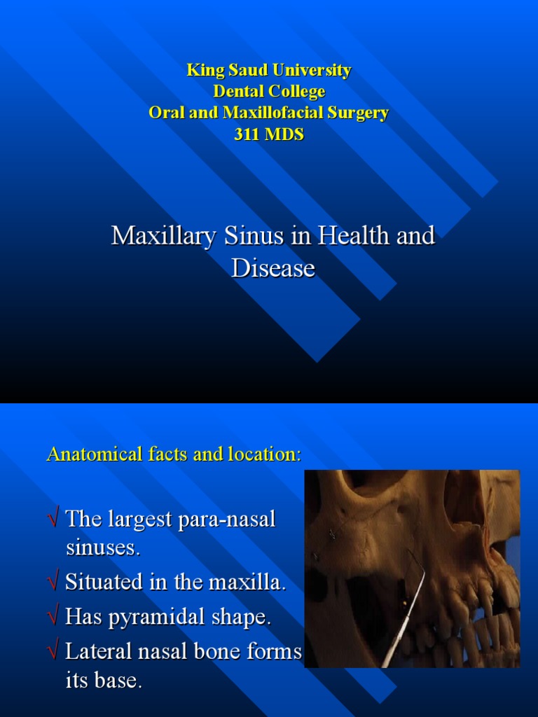 Maxillary Sinus: Anatomy, Physiology, Pathology, Clinical Examination ...