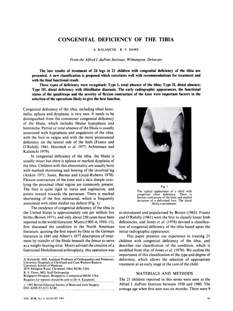 Congenital Deficiency of The Tibia | PDF | Prosthesis | Amputation