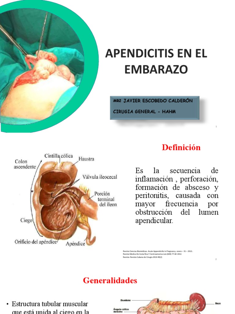 Apendicitis en El Embarazo | PDF | Gastroenterología | Especialidades ...