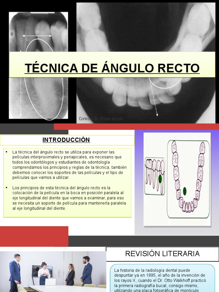 1 Técnica-De-Ángulo-Recto | Descargar gratis PDF | Rayo X | Radiografía