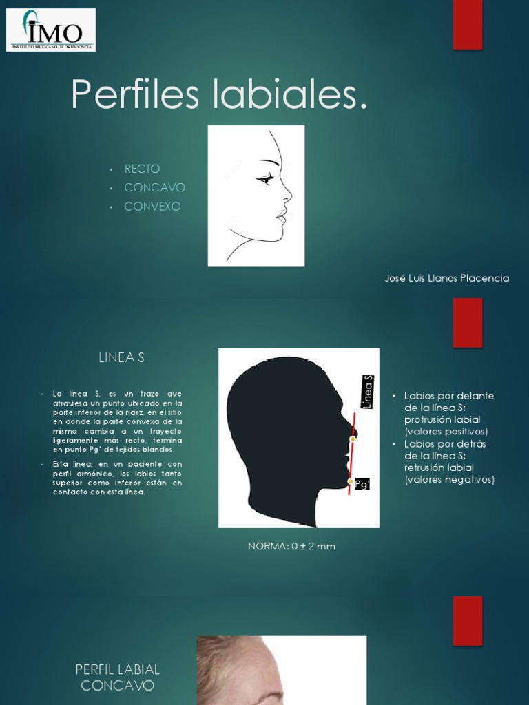 Perfiles Labiales | PDF