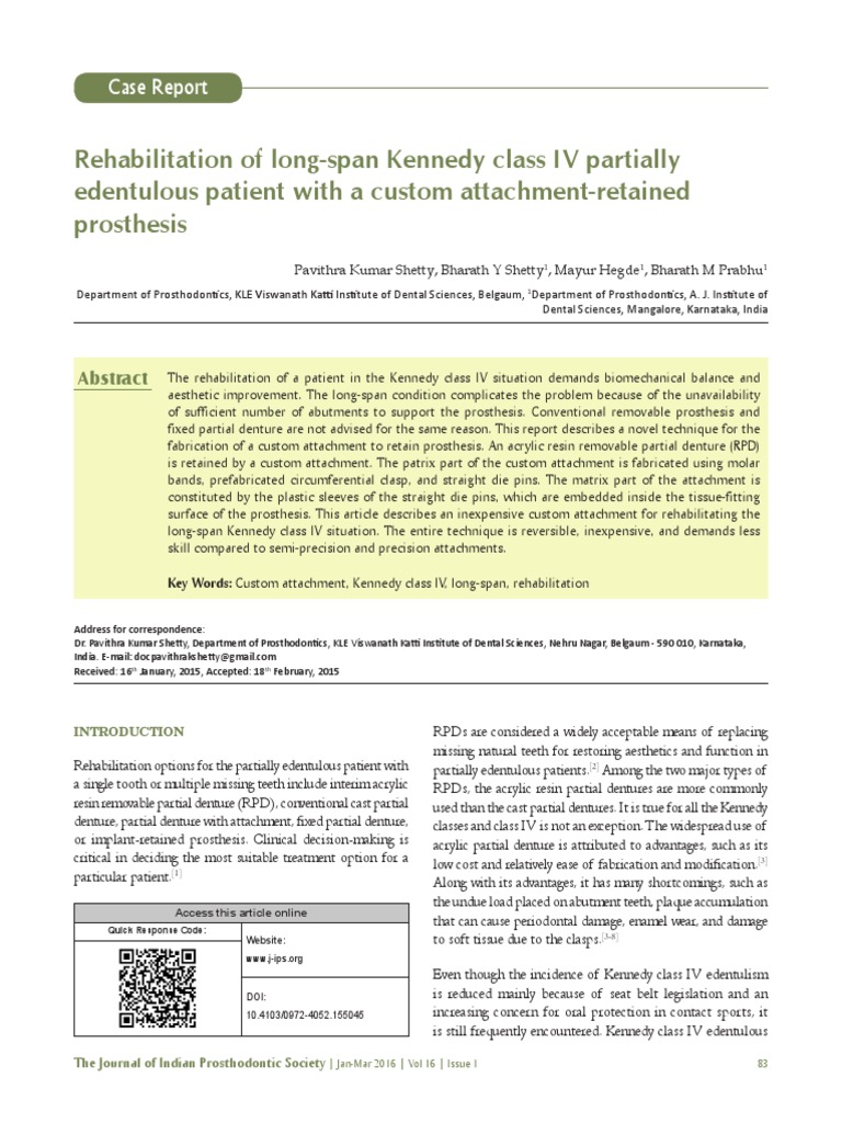Rehabilitation of Long Span Kennedy Class IV Partially Edentulous ...