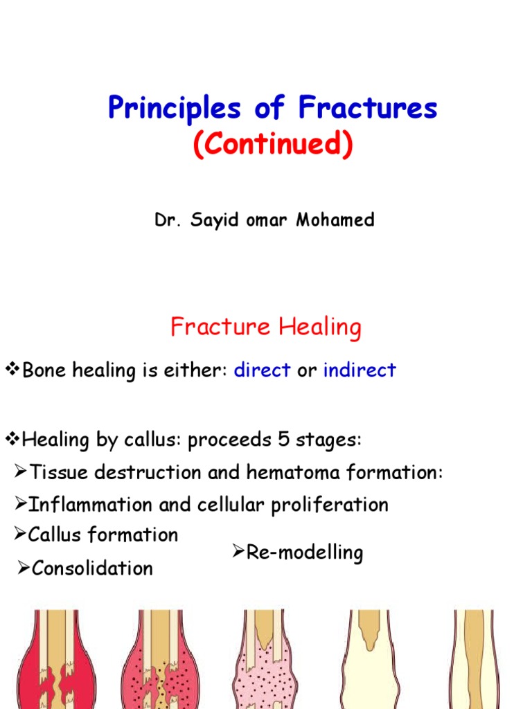 Fracture Healing and Treatment Principles | PDF | Physiology | Health ...