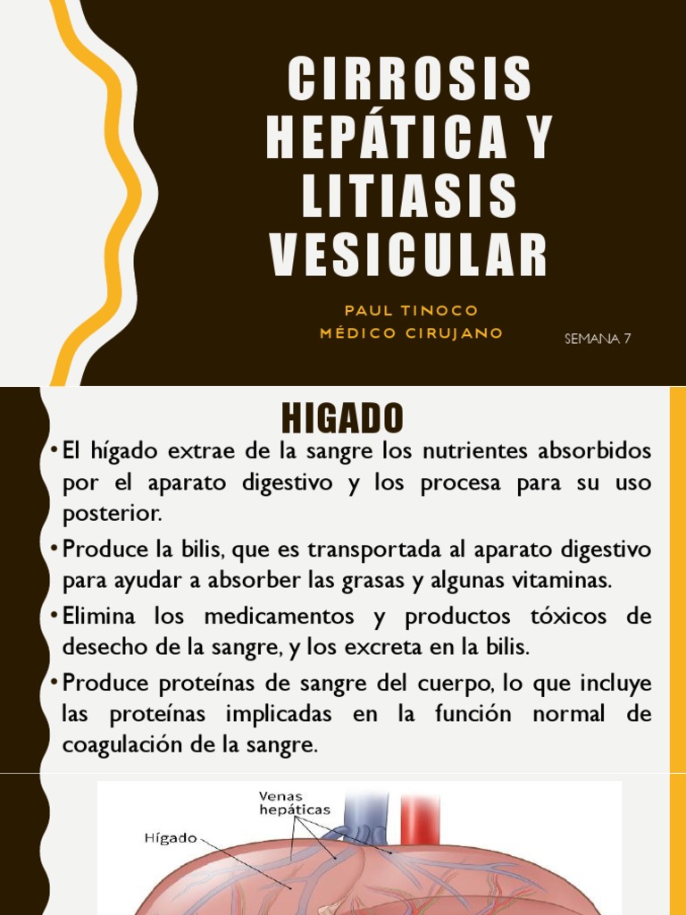 Cirrosis Hepática y Litiasis Biliar | PDF | Cirrosis | Especialidades ...
