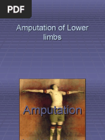 Syme's Amputation: Techniques and Insights | PDF | Prosthesis | Amputation