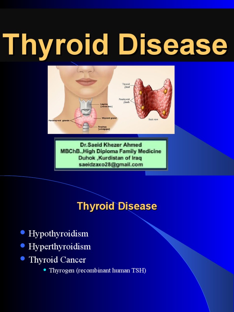Thyroiddisease 190216062020 | PDF | Hypothyroidism | Hyperthyroidism