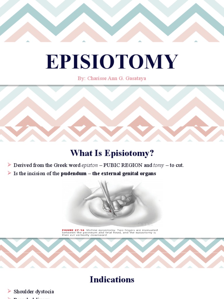 Episiotomy: By: Charisse Ann G. Gasataya | PDF | Surgical Suture | Wound