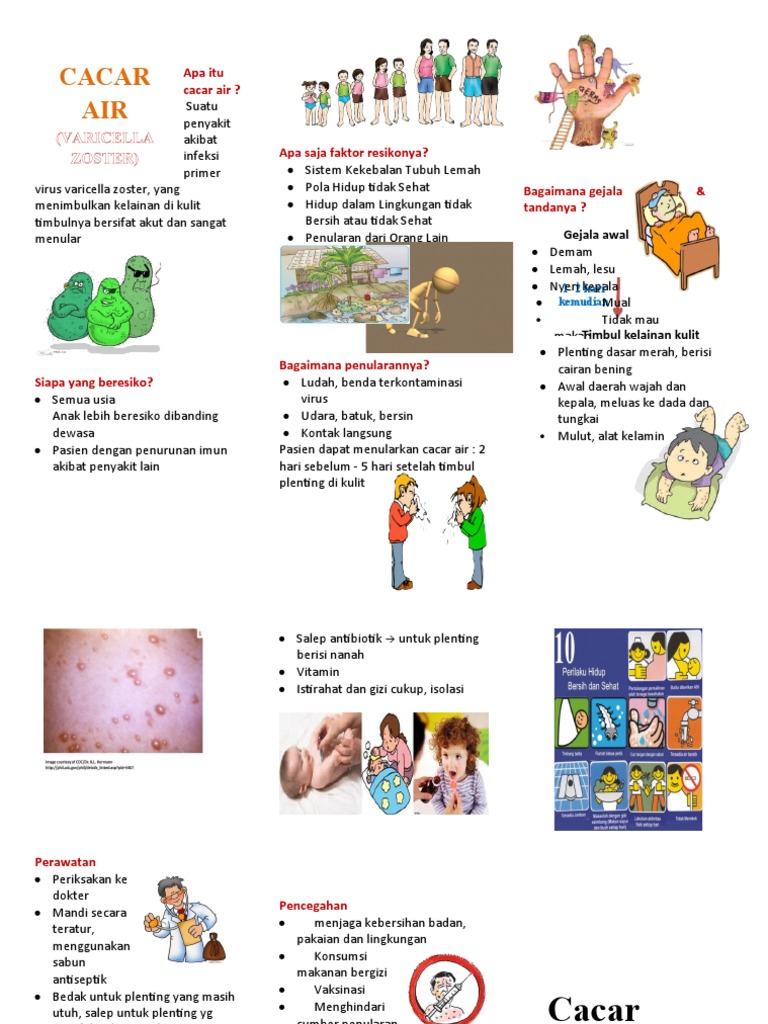 VARICELLA ZOSTER Leaflet | PDF