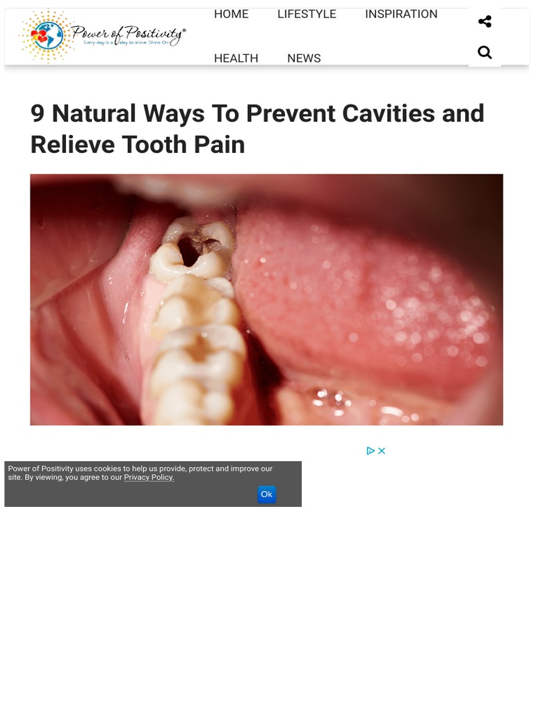 9 Natural Ways To Prevent Cavities and Relieve Tooth Pain | PDF | Oral ...