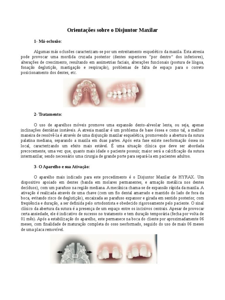 orientações hyrax | PDF | Dente | Boca