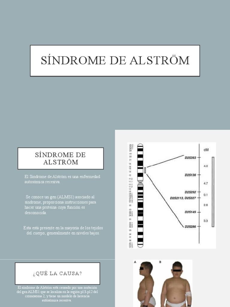 Síndrome de Alström | PDF | Mutación | Diagnostico medico