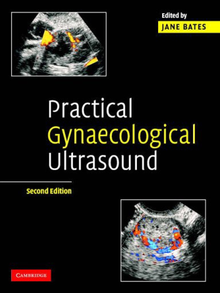Practical Gynaecological Ultrasound PDF | PDF