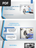 Pitch y TC Helicoidal | PDF | Ct Scan