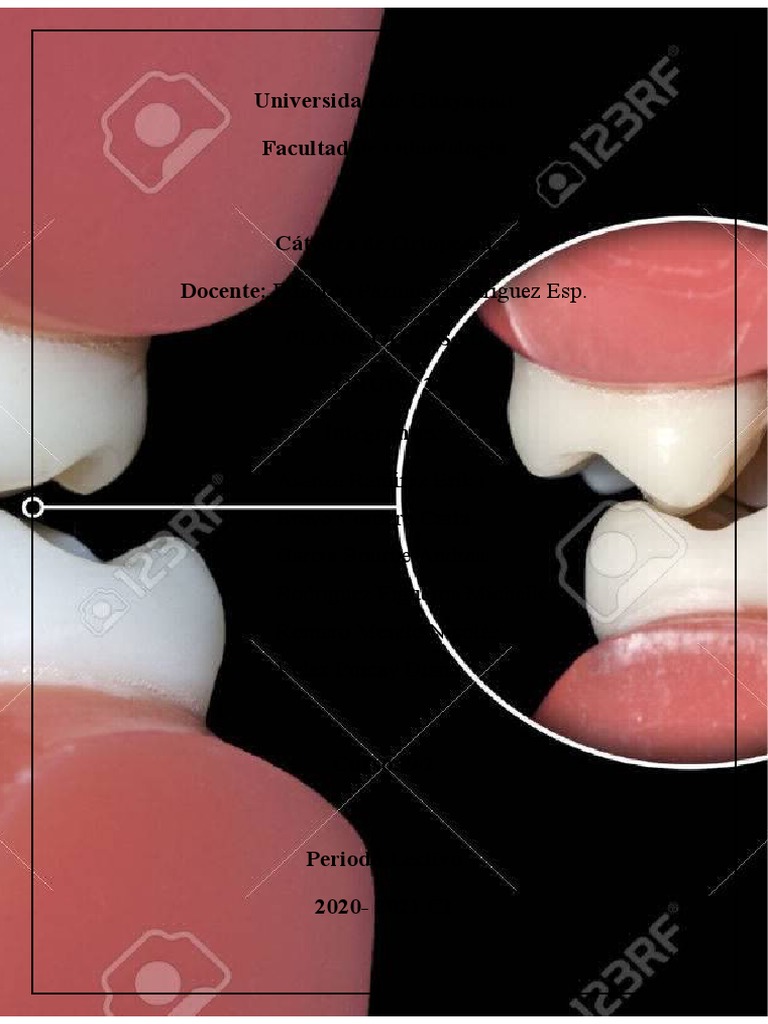 Grupo 3 - Plano Oclusal | PDF | Ortodoncia | Diente