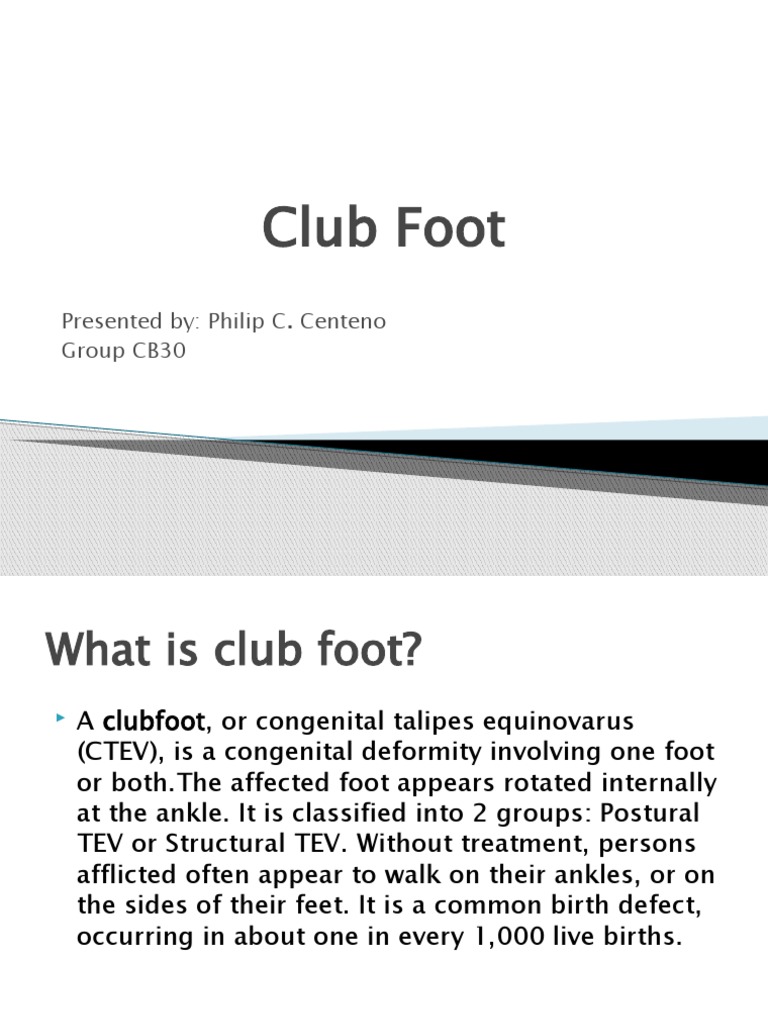 Club Foot POC Report | PDF | Foot | Human Diseases And Disorders