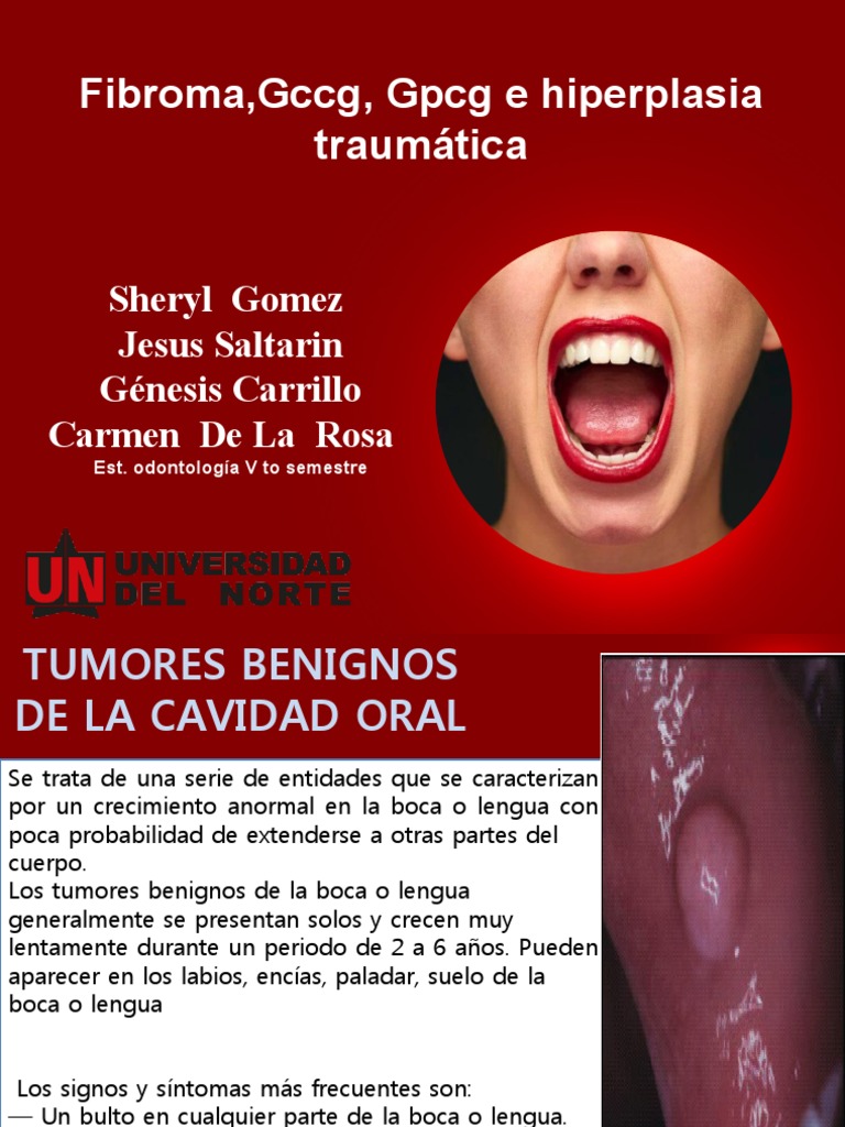 Fibroma, GCCG, GCCP, Hiperplasia Traumatica | PDF | Cáncer | Neoplasias