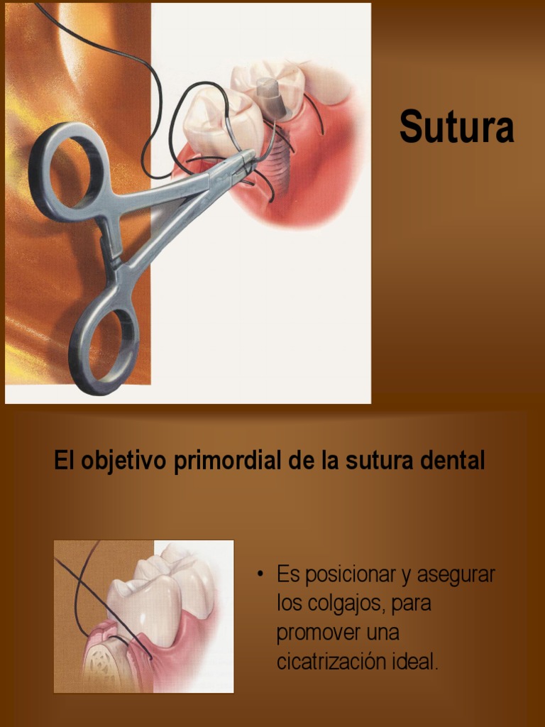Clase de Suturas PDF | PDF | Sutura Quirúrgica | Medicina CLINICA