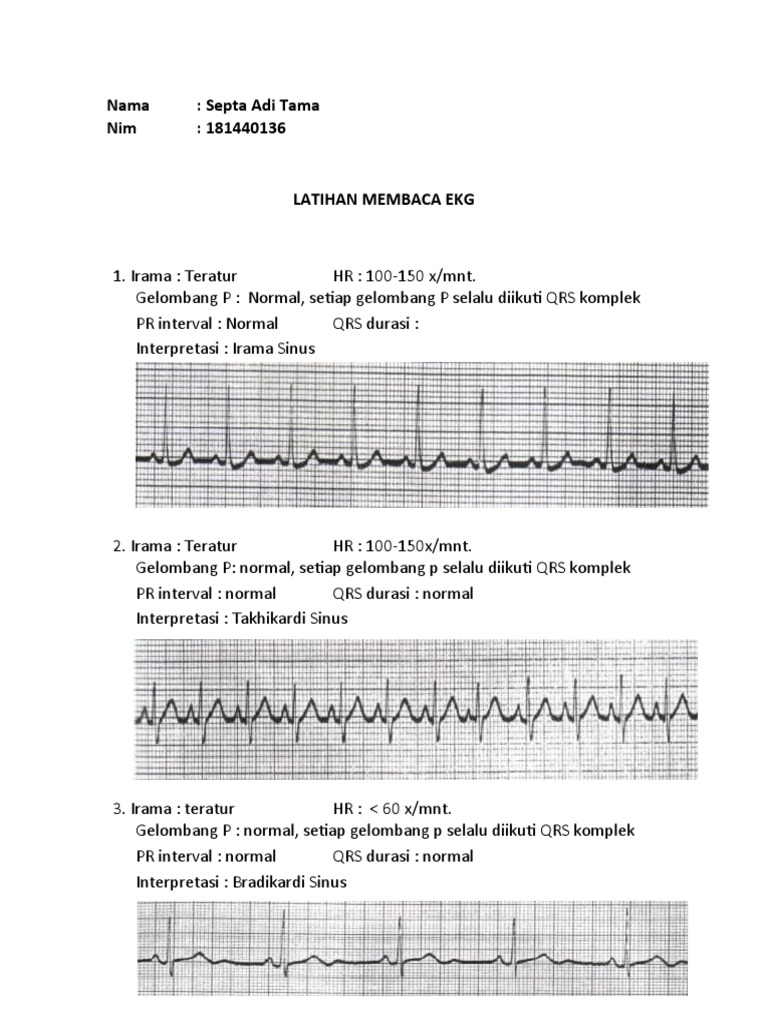 LEMBARAN PENUGASAN Interpretasi Gambaran EKG PDF