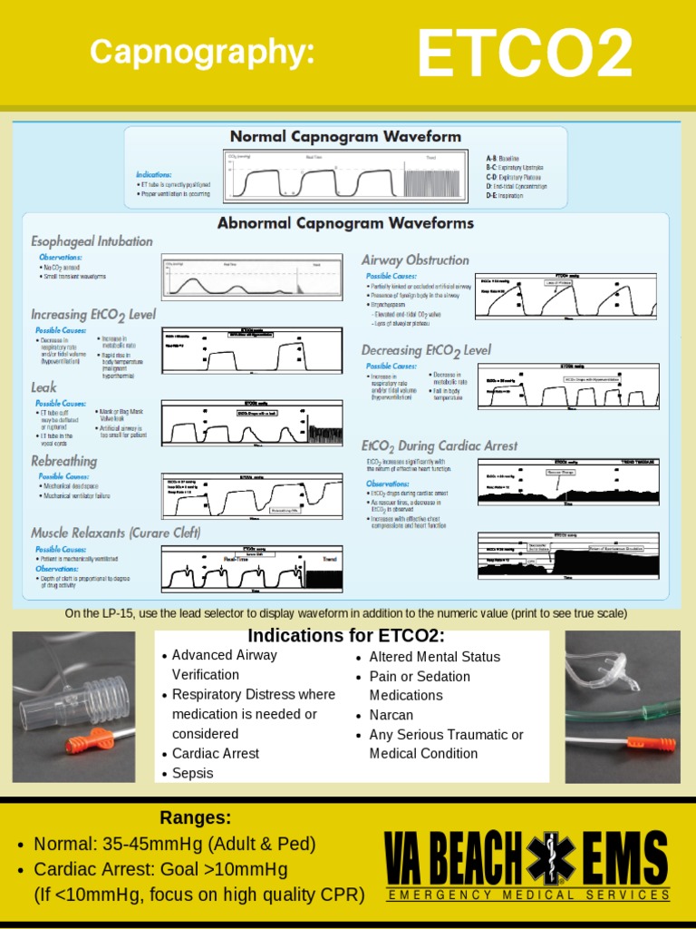 Capnography Waveform Cheat Sheet | PDF