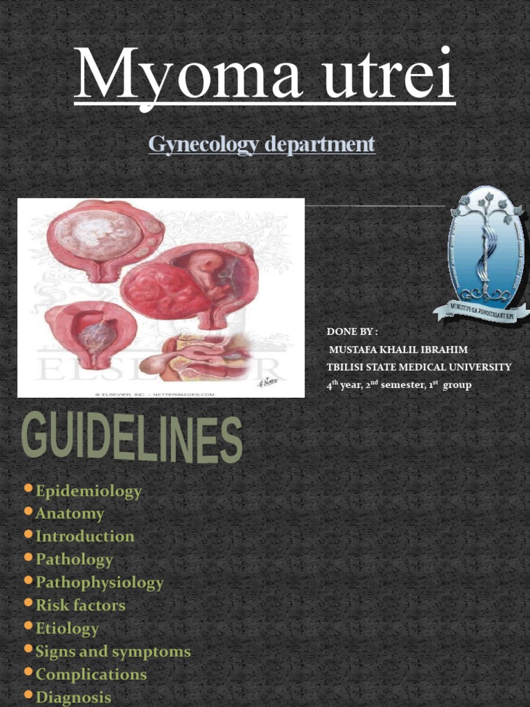 Myoma Utrei: Gynecology Department | PDF | Benign Tumor | Uterus