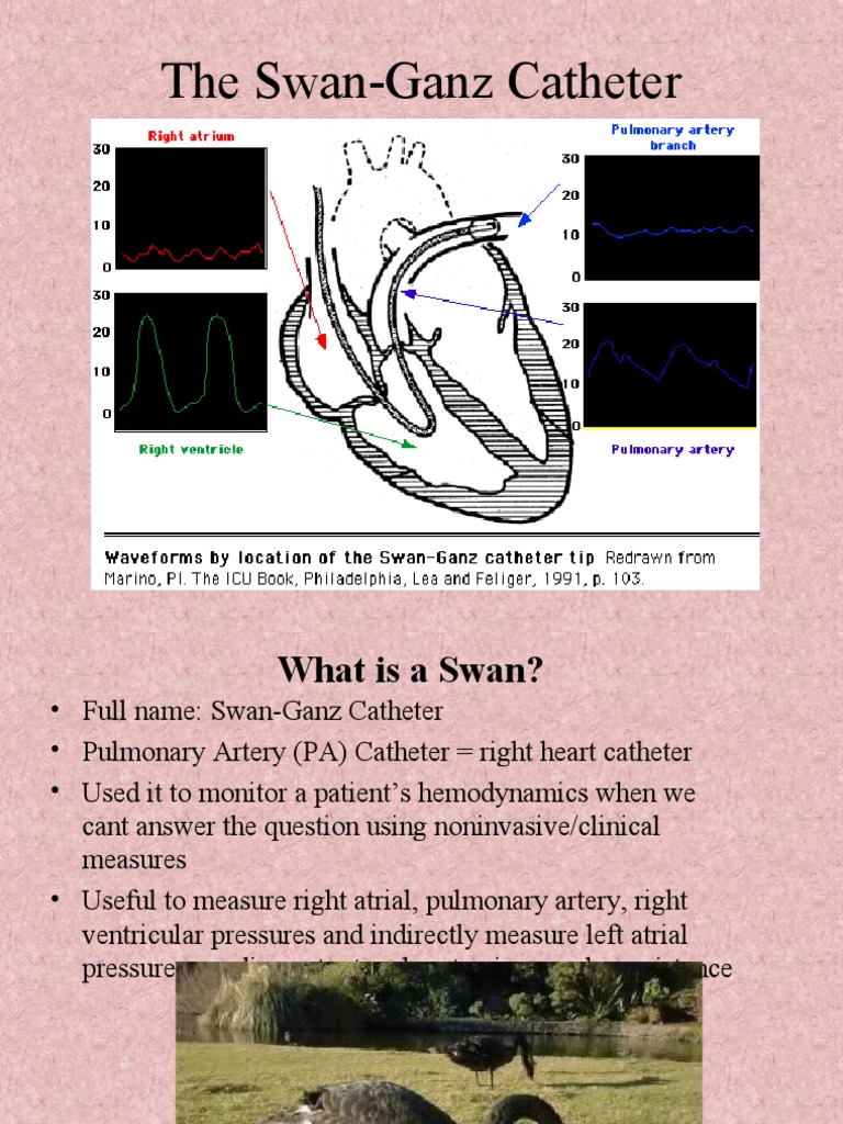 The Swan-Ganz Catheter | PDF | Atrium (Heart) | Blood Pressure