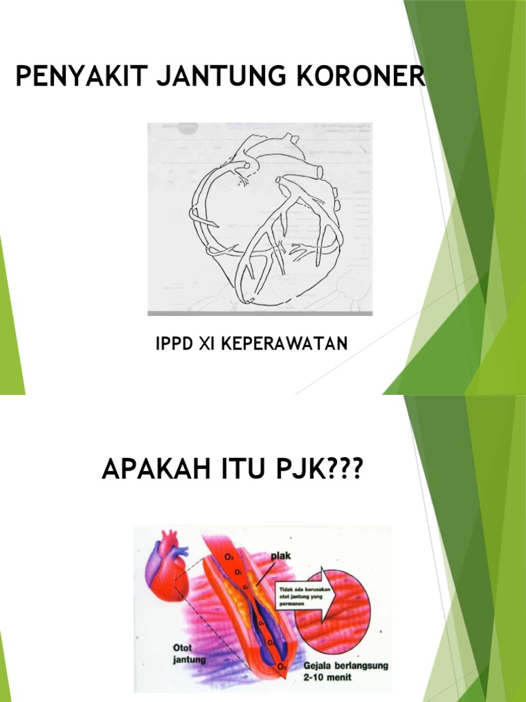 Penyakit Jantung Koroner: Ippd Xi Keperawatan | PDF