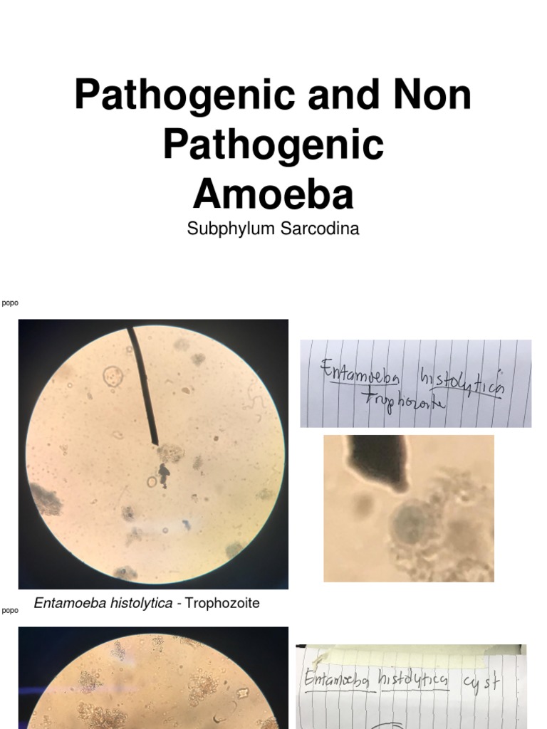 Pathogenic and Non Pathogenic Amoeba: Subphylum Sarcodina | PDF ...