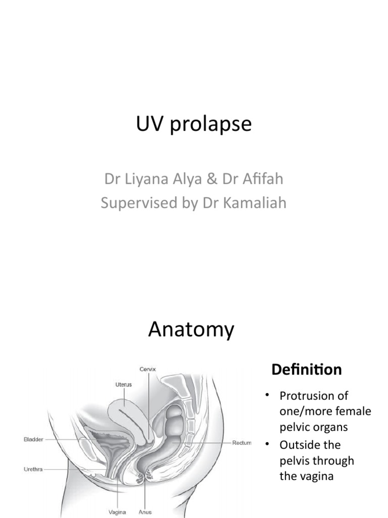 UV Prolapse: DR Liyana Alya & DR Afifah Supervised by DR Kamaliah | PDF ...