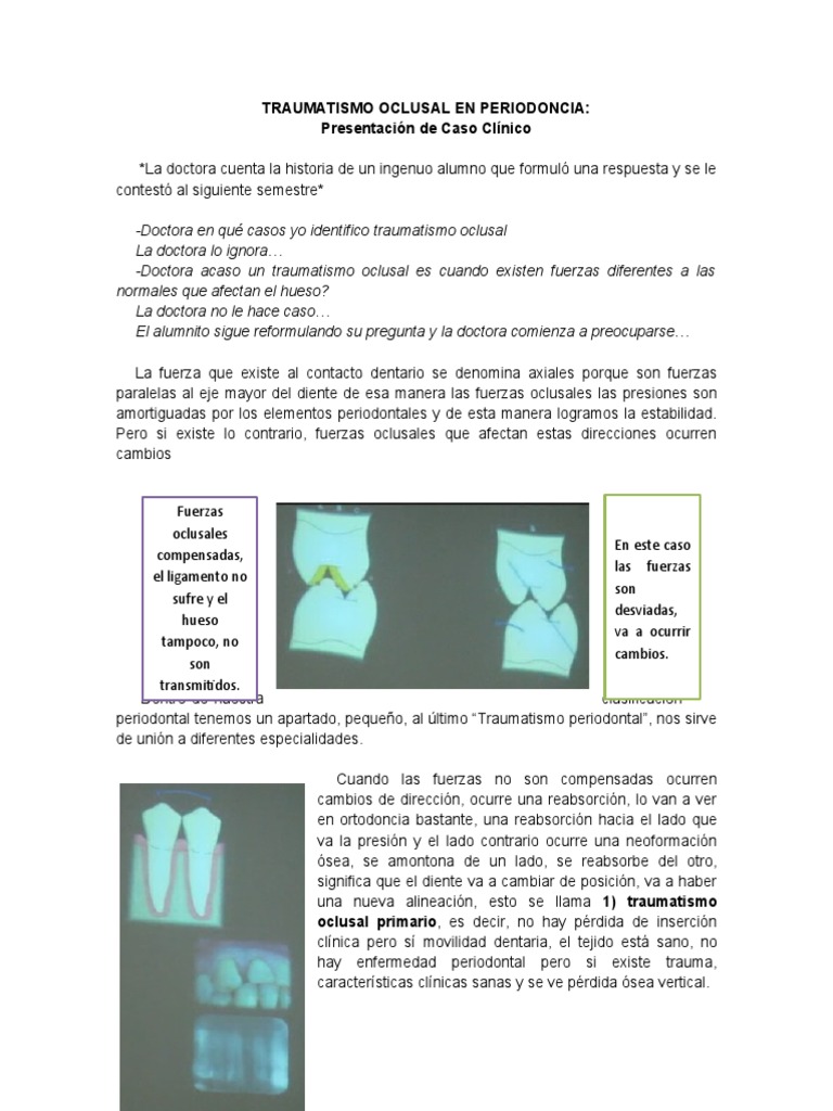 Traumatismo Oclusal en Periodoncia | PDF | Odontología | Lesión